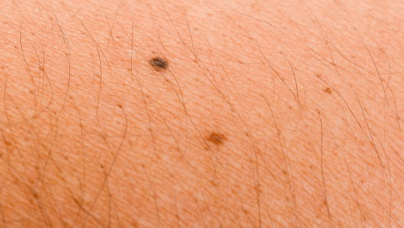Dermatología Clínica | Dra. Magally Núñez